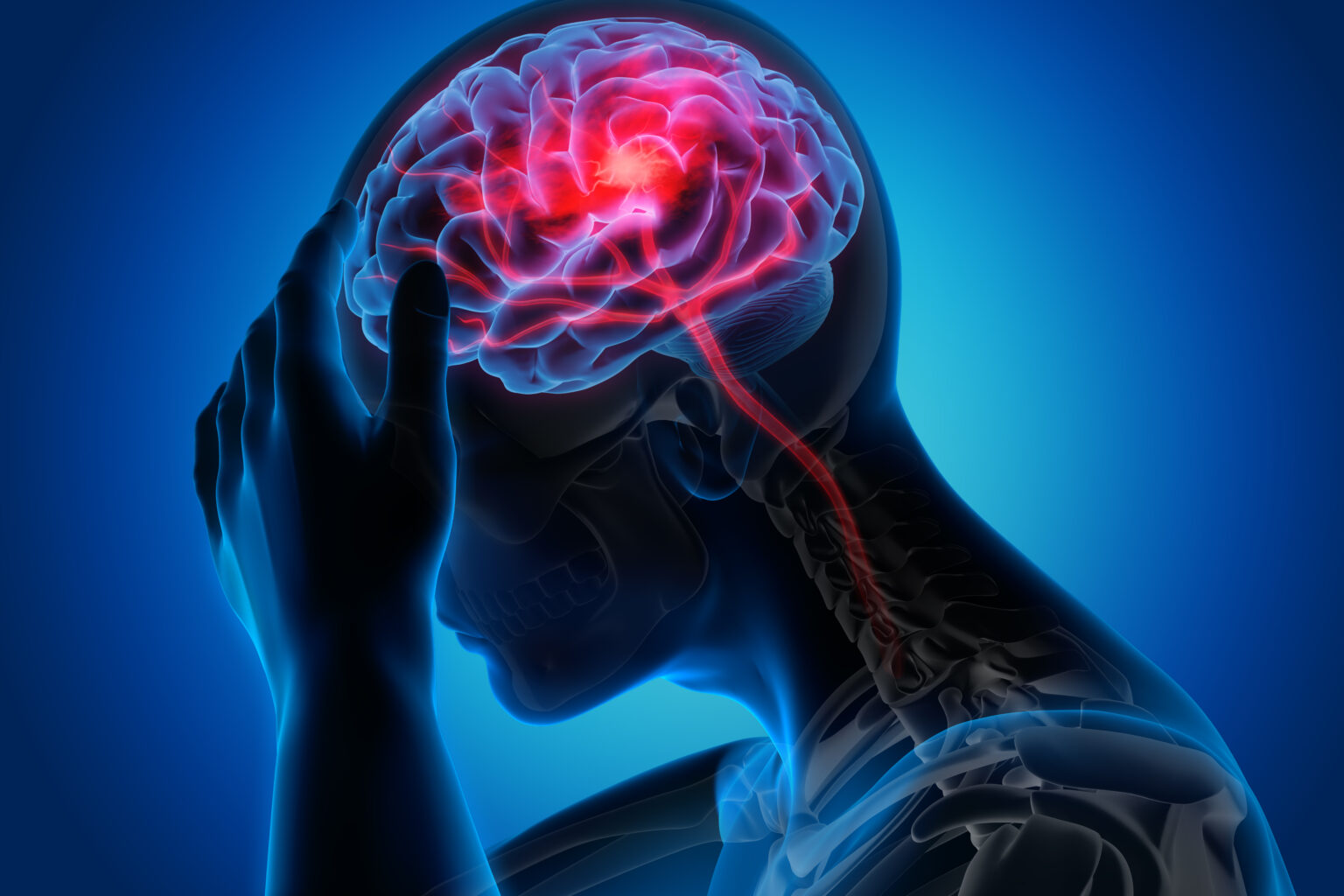 Distinguishing Mild Neurocognitive Disorder Due to TBI in DSM-5 from ...