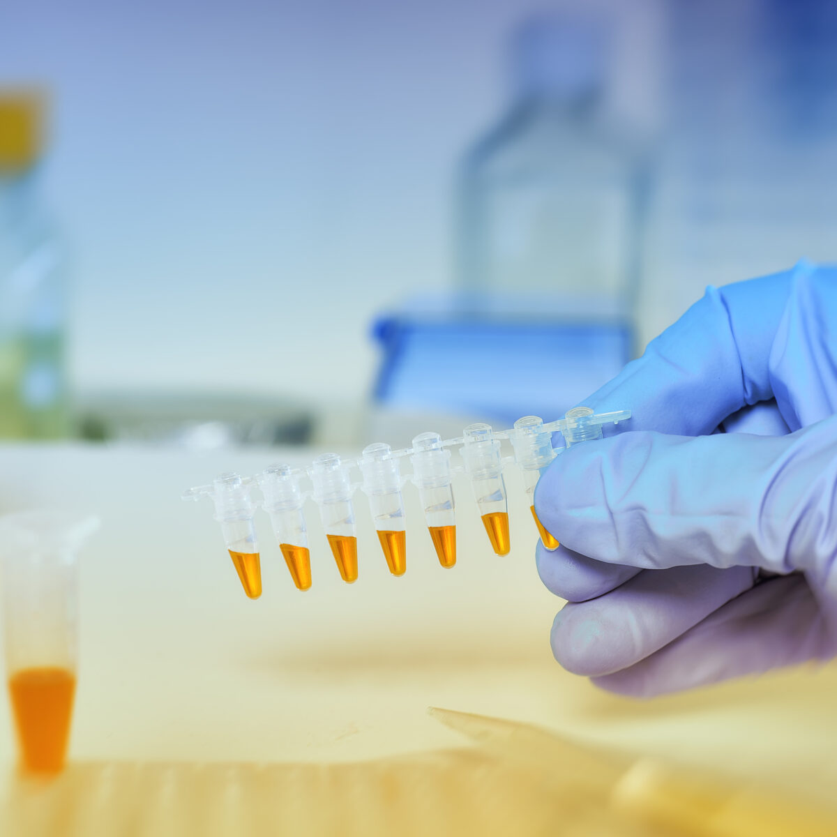 The Mayo classification system | myneuronews.com